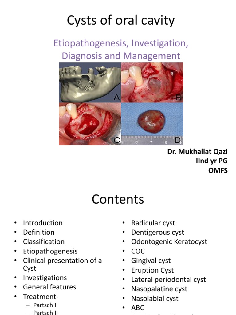 Classification of Oral Cysts Overview | PDF | Mouth | Animal Anatomy