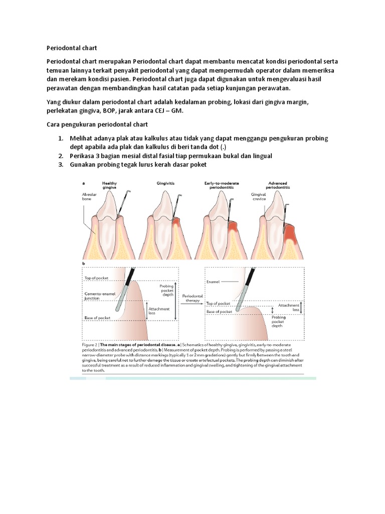 Periodontal Chart | PDF