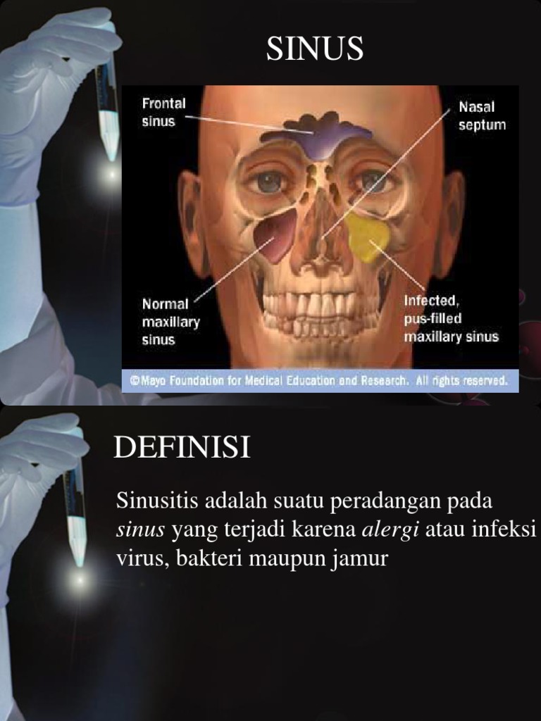 SINUS | PDF