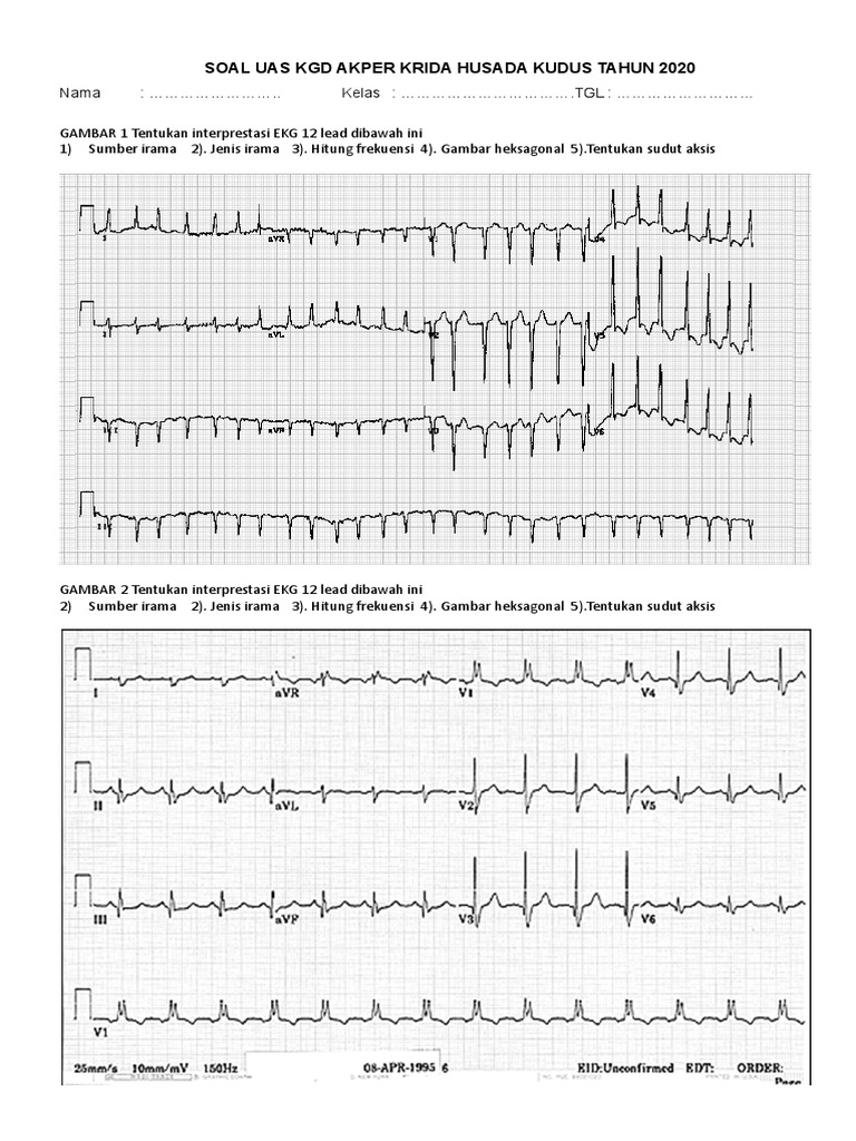 SOAL UAS Ekg | PDF
