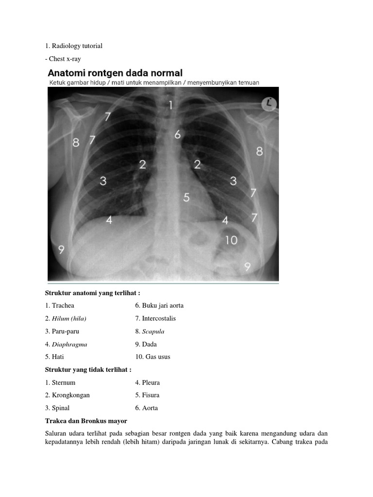 Analisis Rontgen Dada Normal | PDF | Perjalanan | Seni