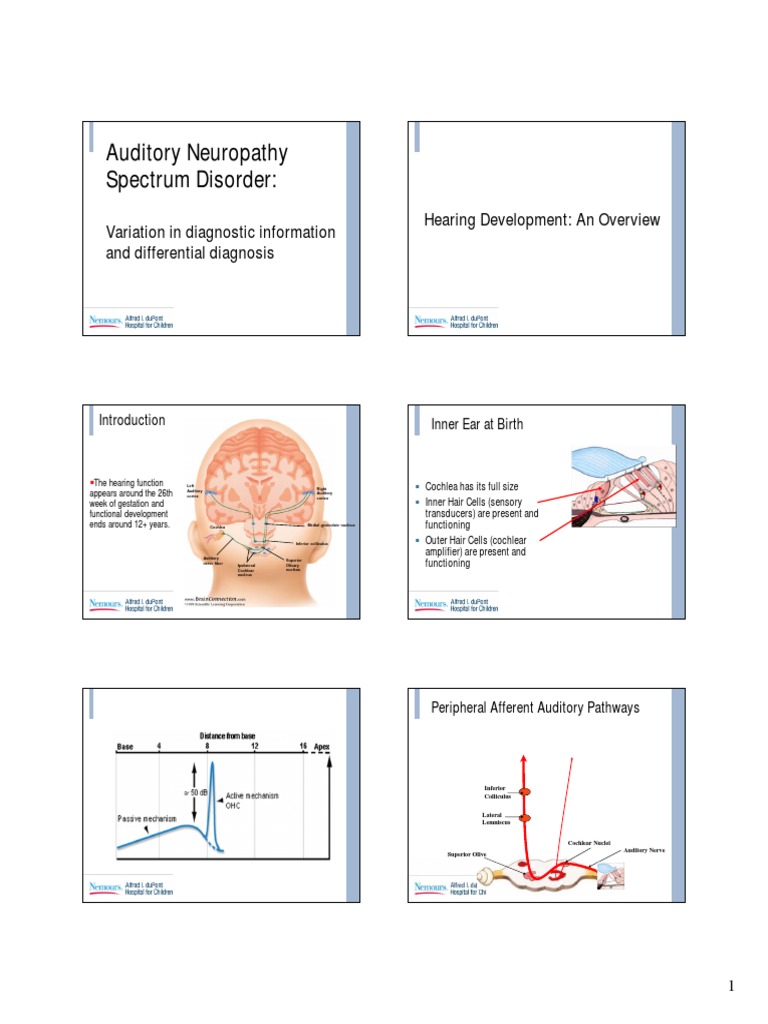 Auditory Neuropathy Morlet | PDF | Auditory System | Hearing Loss