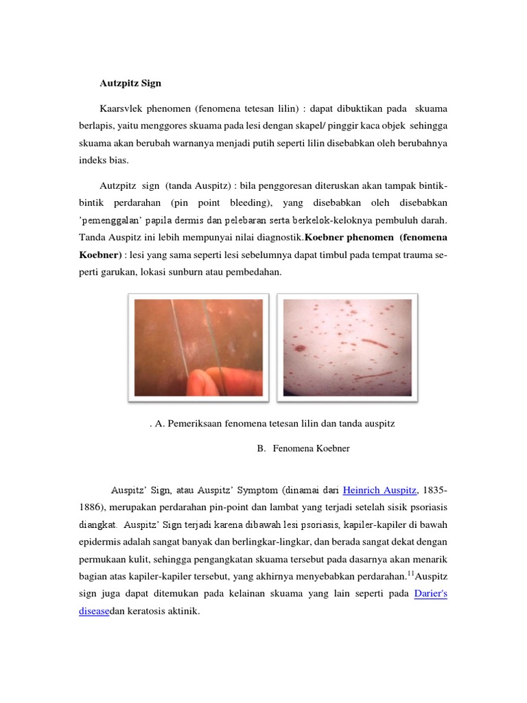 Tanda Auspitz dan Fenomena Koebner | PDF | Seni