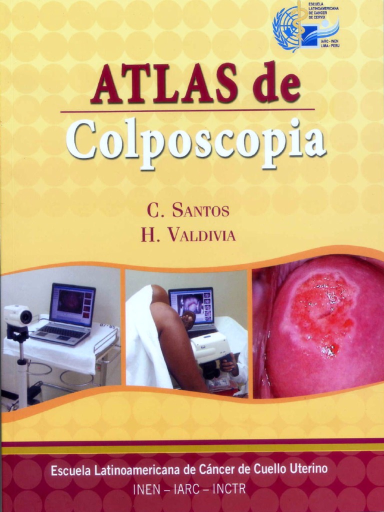 Atlas de Colpos PDF | PDF