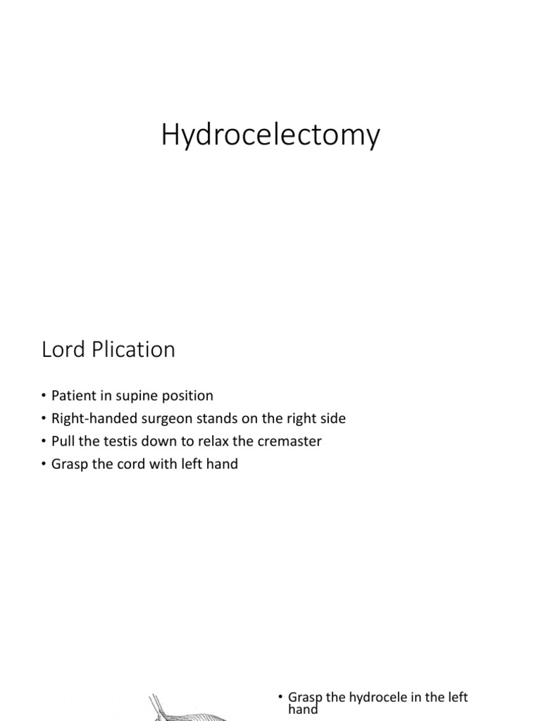 Hydrocelectomy | PDF