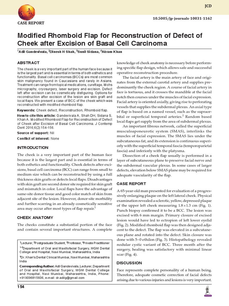 Modified Rhomboid Flap For Facial Reconstruction | PDF | Medical ...