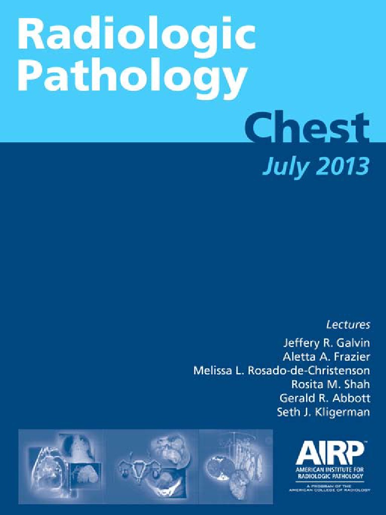 2013 July Chest Section PDF | PDF | Lung | Respiratory Diseases