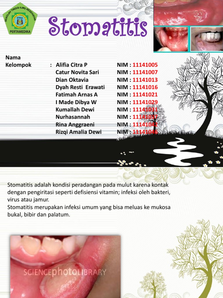 Stomatitis | PDF