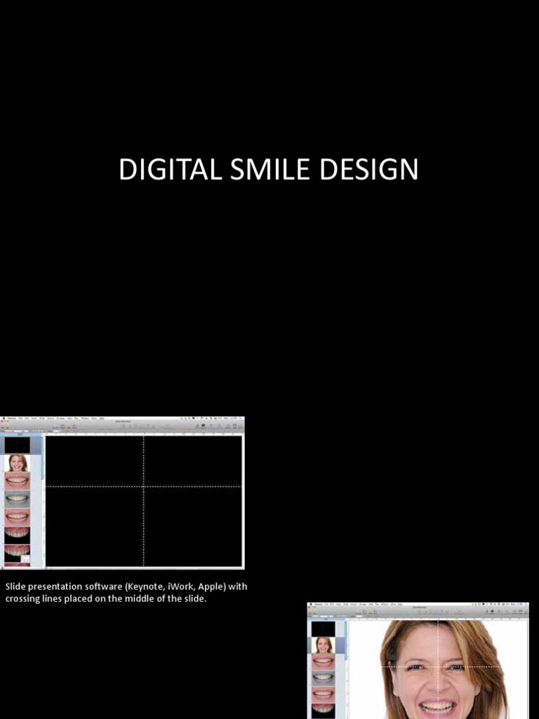 Digital Smile Design Process Guide | PDF | Mouth | Dentistry