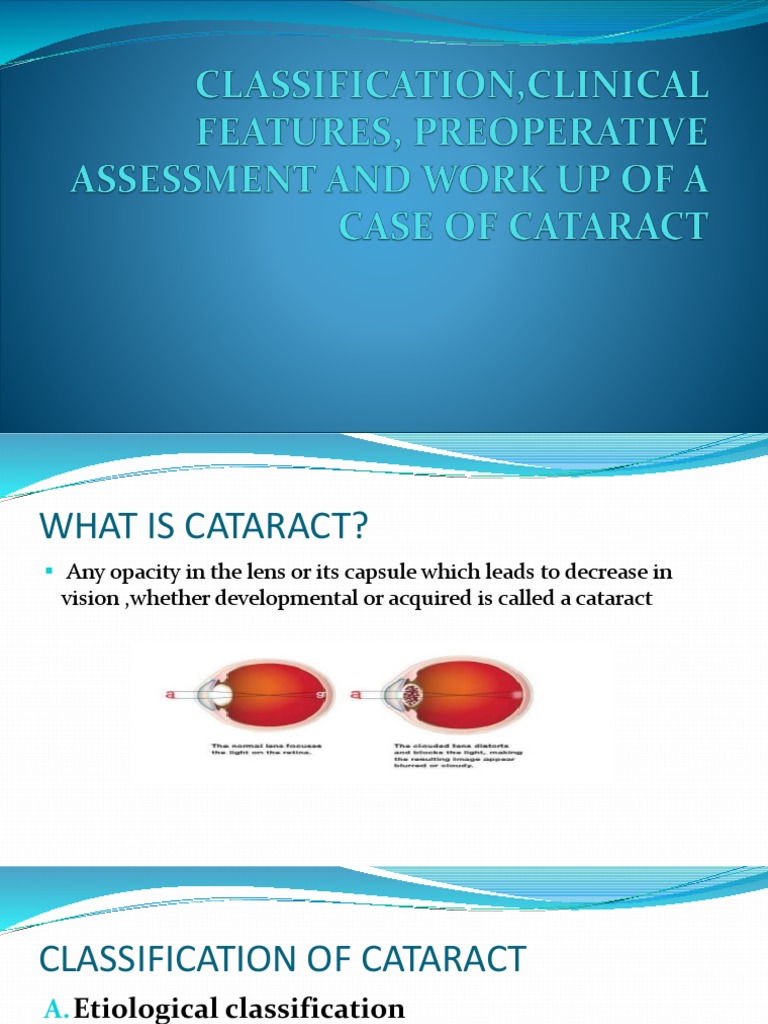 Cataract | PDF | Cataract | Human Eye