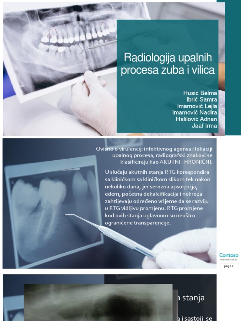 Radiologija Upalnih Procesa Zuba I Vilica | PDF