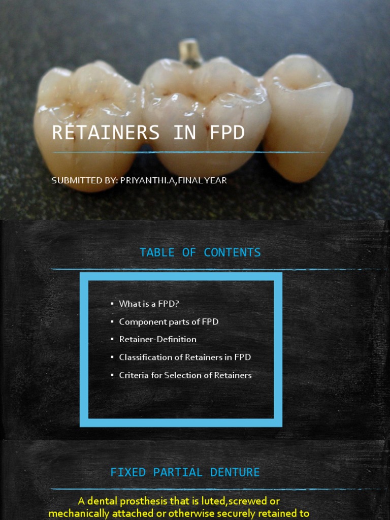 Retainers in FPD | PDF | Mouth | Dentistry