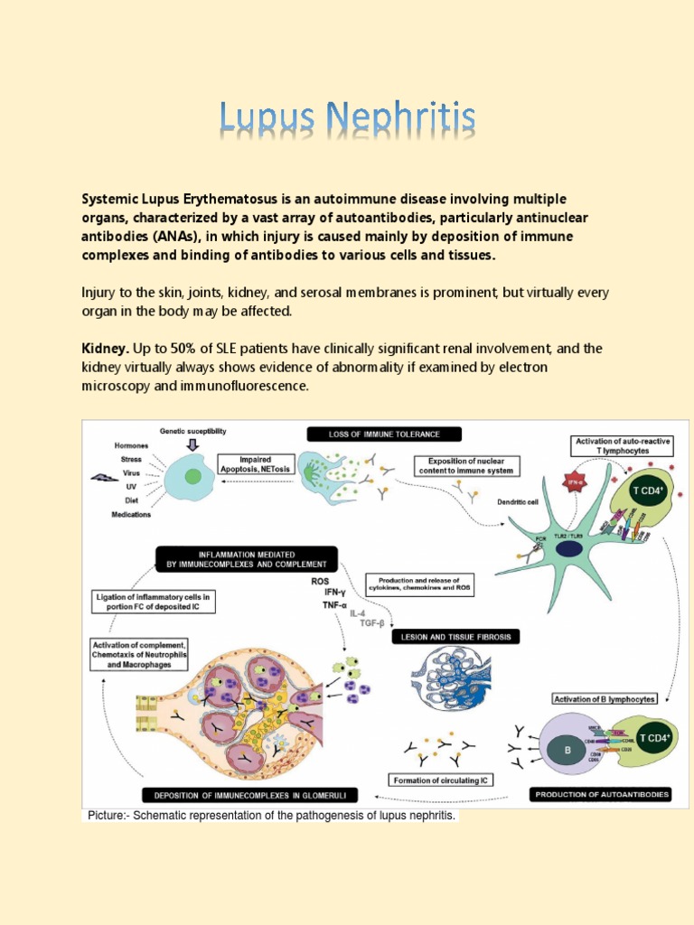 Systemic Lupus Erythematosus Assignment | PDF | Systemic Lupus ...