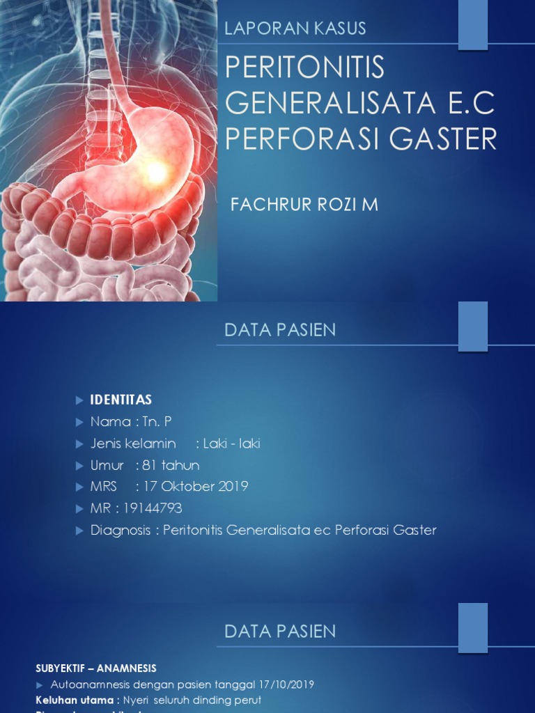 Peritonitis Generalisata e | PDF