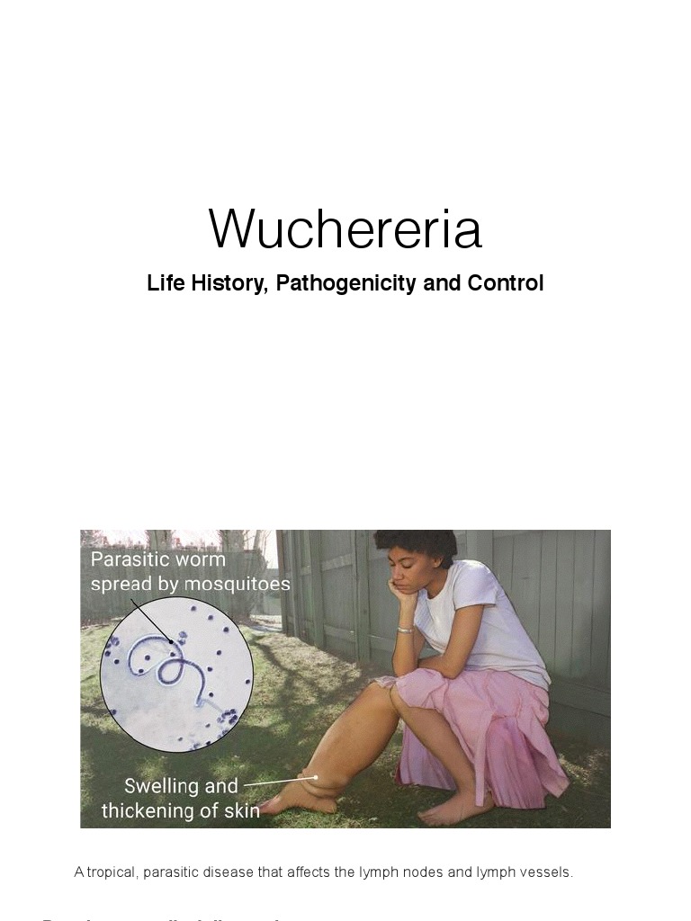 Wuchereria Bancrofti | PDF | Lymphatic System | Inflammation