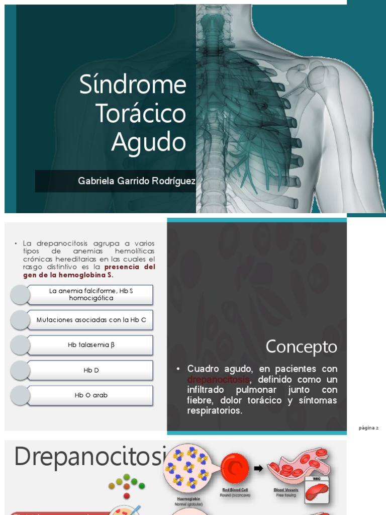 Síndrome Torácico Agudo Care Guide Information En Espanol – PIPIH