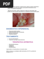 Operculectomía: Técnica y Procedimiento | PDF | Diente humano ...