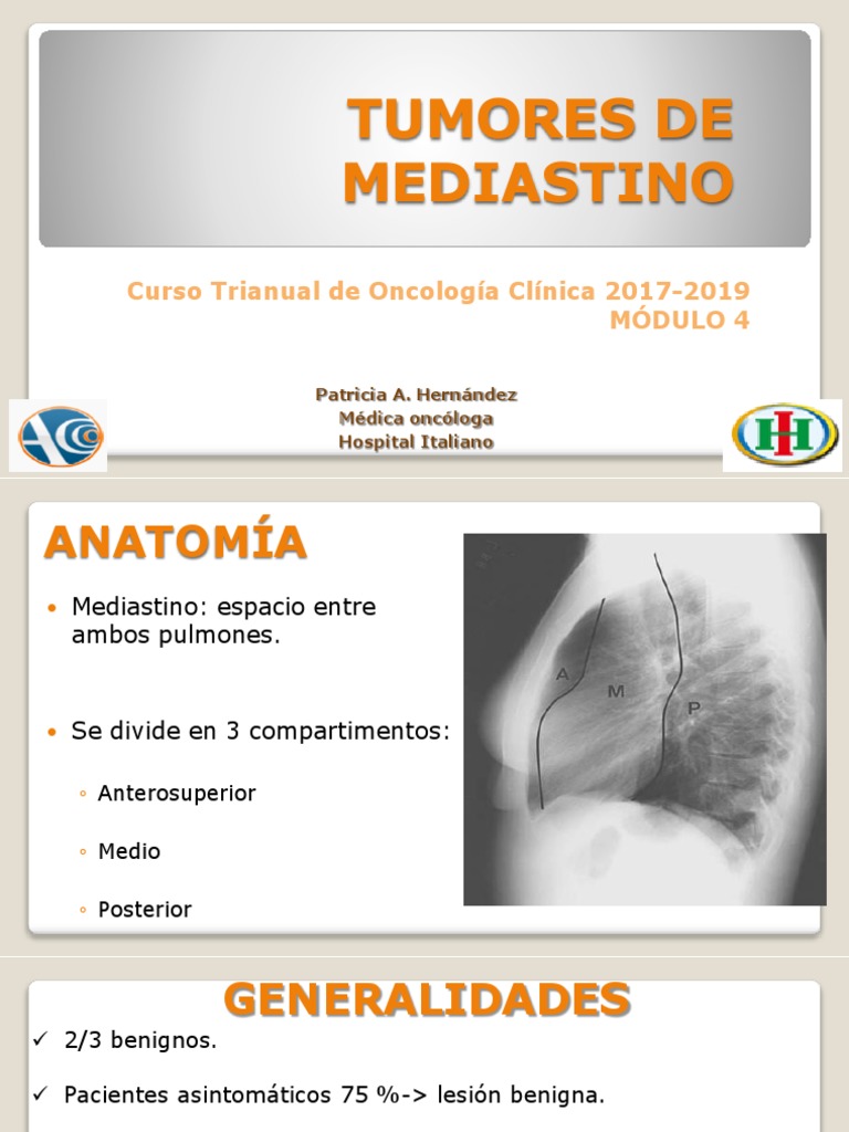 Tumores de Mediastino | PDF | Linfoma | Cáncer