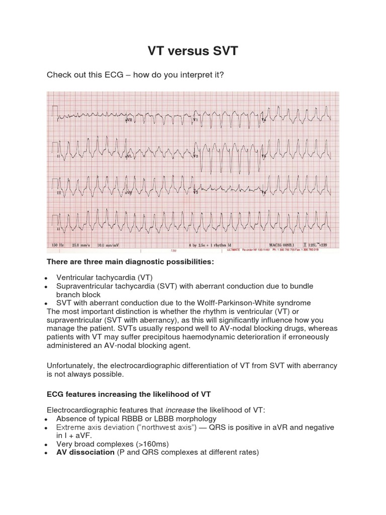 VT Versus SVT | PDF | Electrocardiography | Cardiovascular Diseases