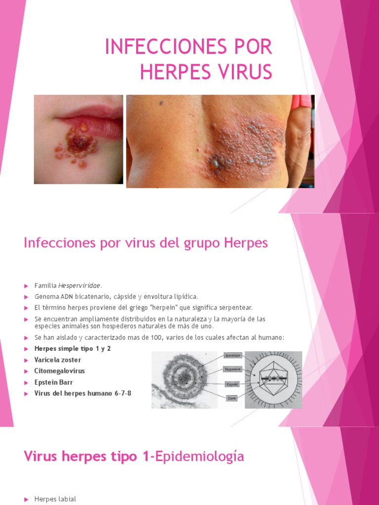 Infecciones Por Herpes Virus | PDF | Herpes Simple | Virus