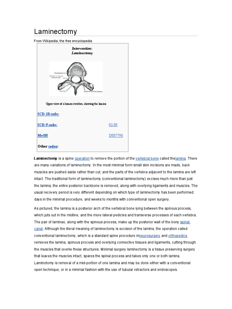 Laminectomy | PDF | Surgery | Nervous System