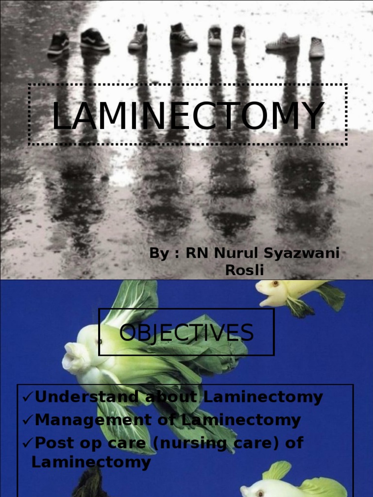 Laminectomy: Procedure and Care Guide | PDF | Vertebra | Vertebral Column