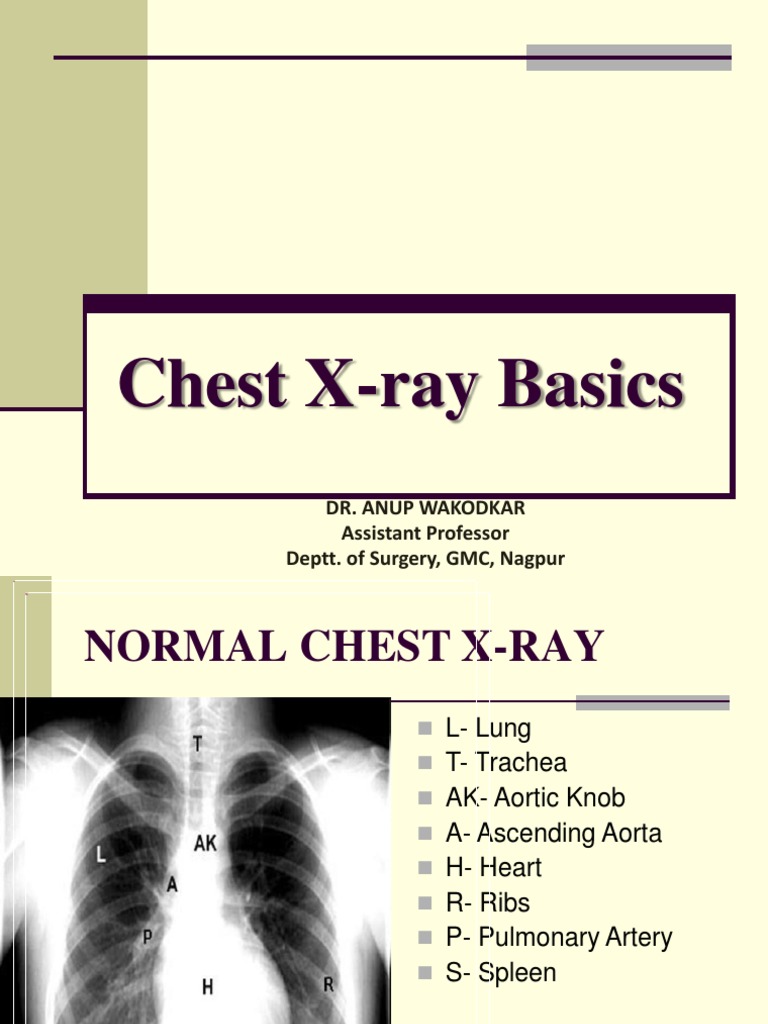 Chest X Ray Basics | PDF | Lung | Respiratory System