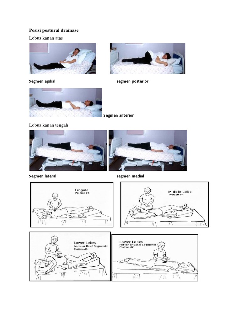 Gambar Posisi Postural Drainase | PDF