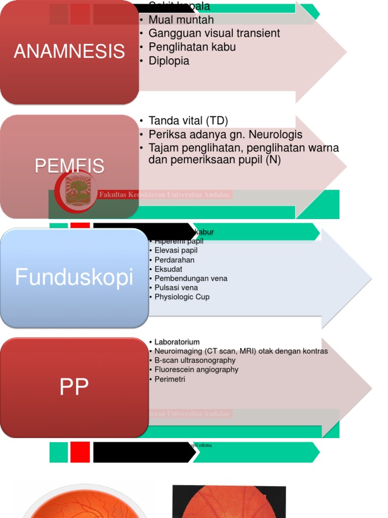 Diagnosis dan Penanganan Papil Edema | PDF