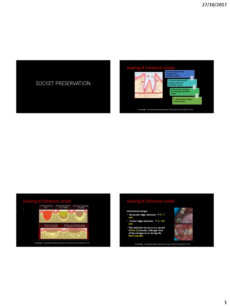 Socket Preservation | PDF | Dental Implant | Mouth