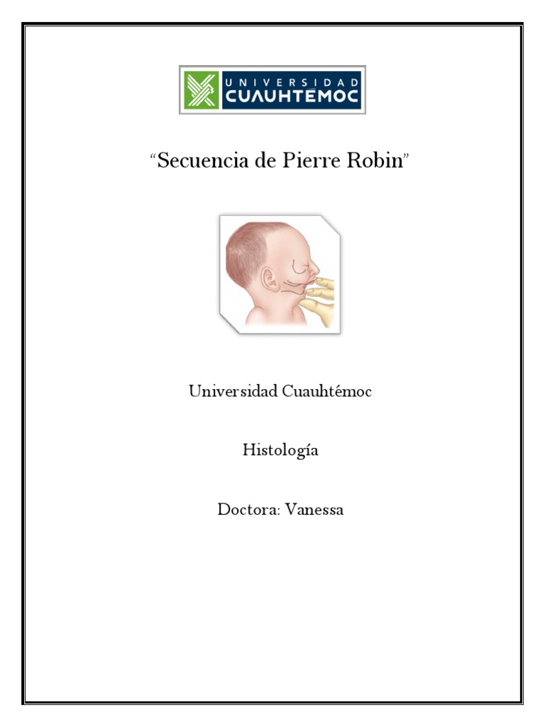 Secuencia de Pierre Robin | PDF | Medicina | Ciencias de la Salud