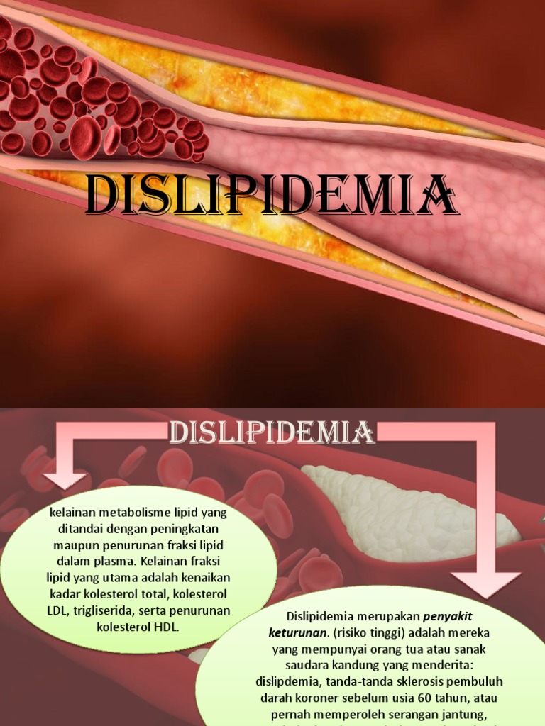 Dislipidemia 2 | PDF