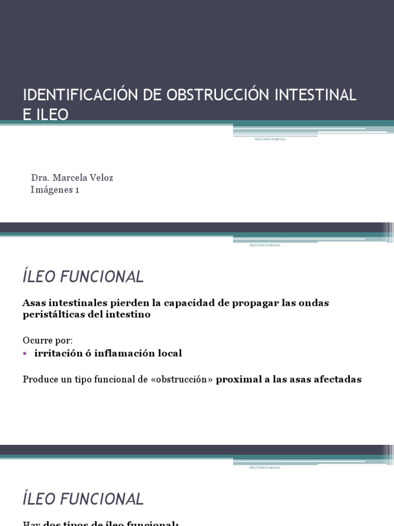 Clase 3 Identificación de Obstrucción Intestinal e Ileo | PDF | Abdomen ...