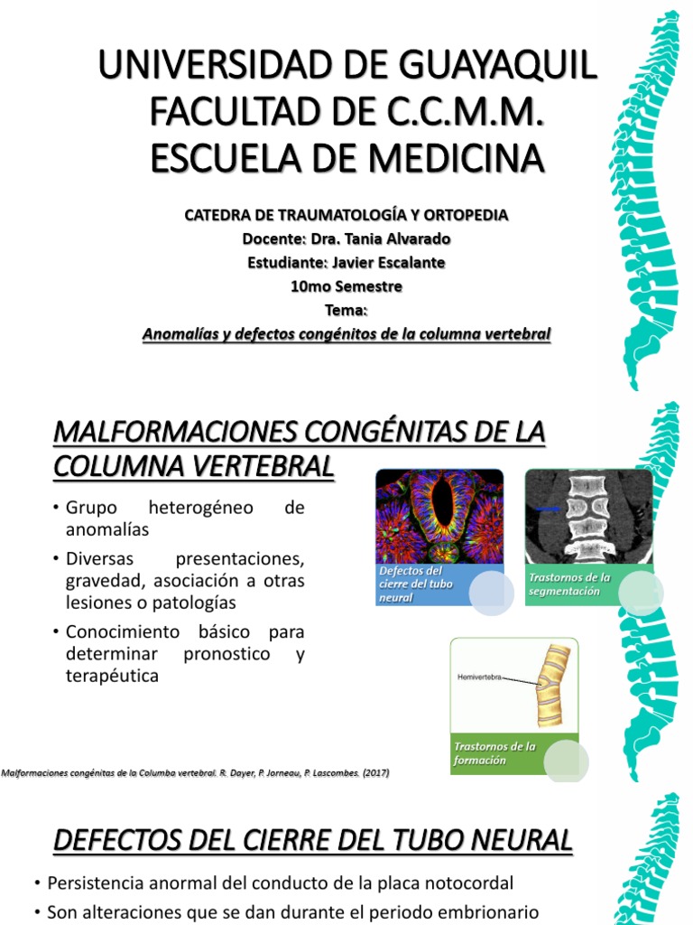 Defectos y Anomalias Congenitas de Columna Vertebral | PDF | Escoliosis ...