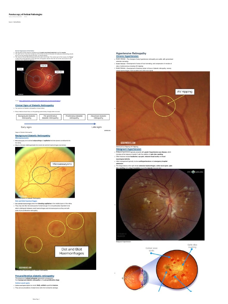 Funduscopy of Retinal Pathologies PDF | PDF | Retina | Glaucoma