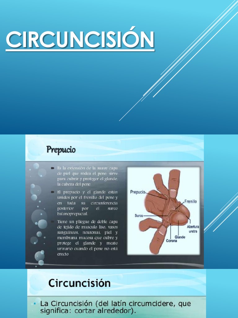 Circuncisión | PDF