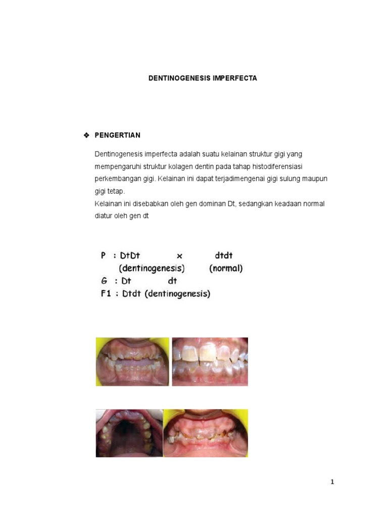 Dentinogenesis Imperfecta | PDF