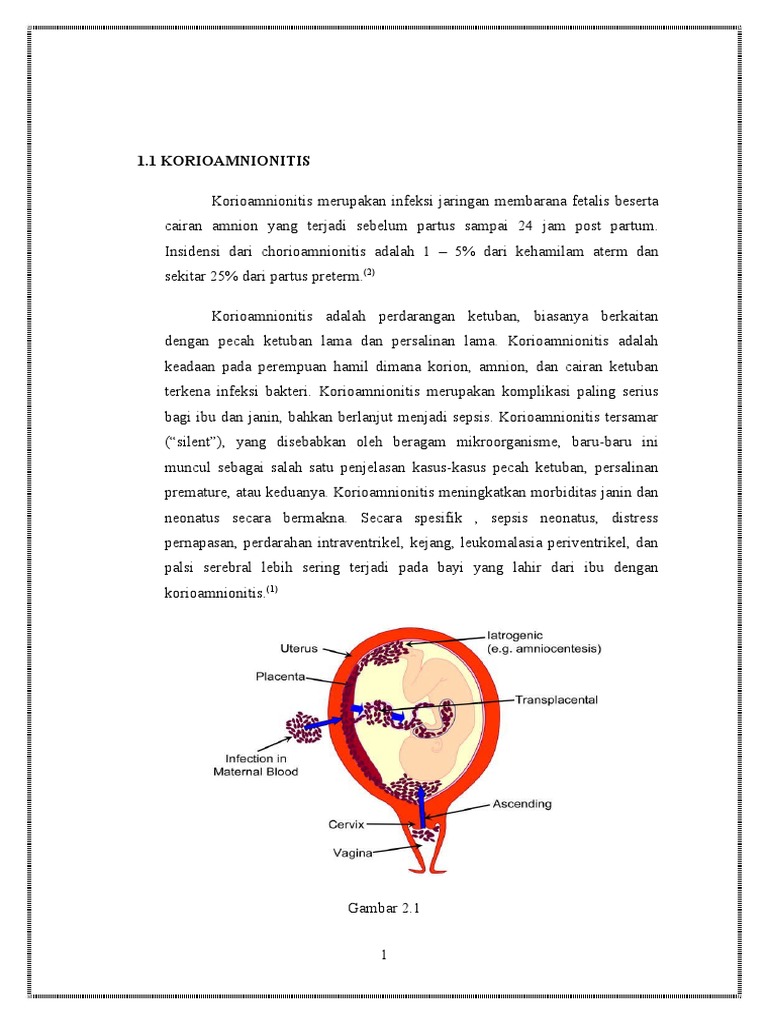 Korioamnionitis | PDF