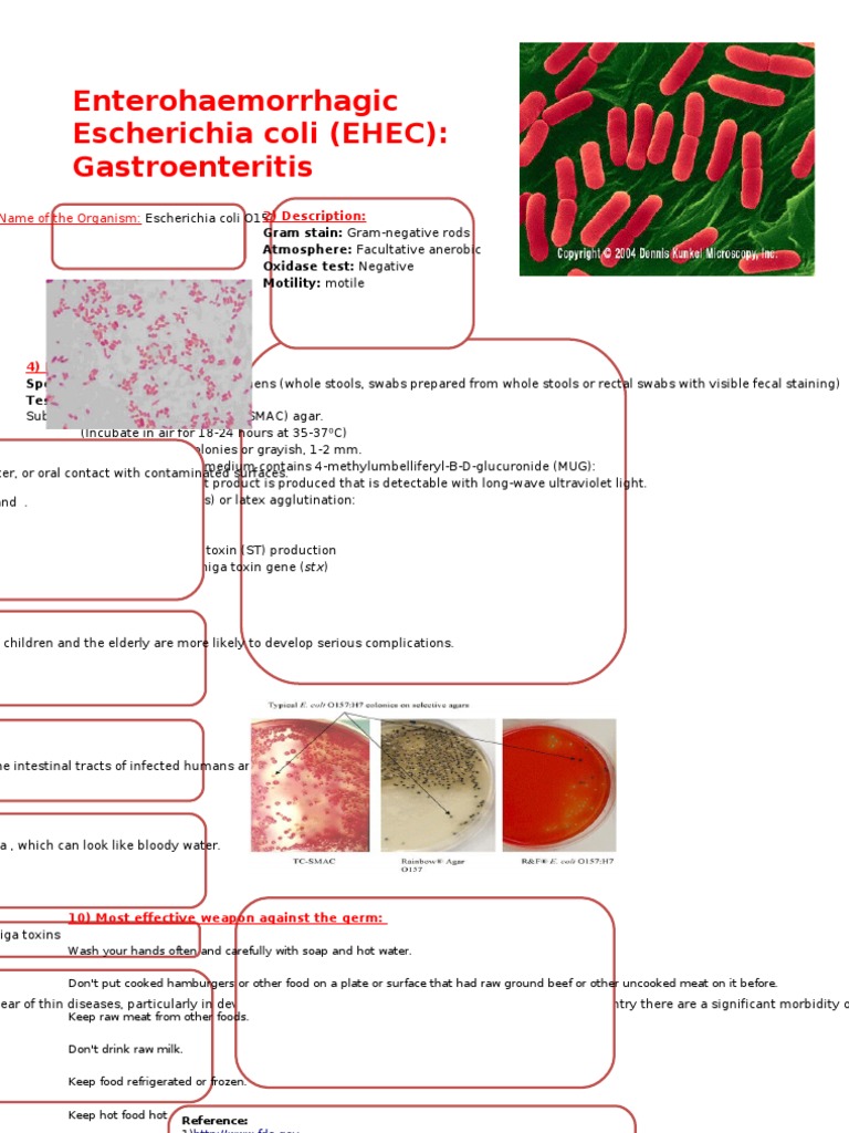 Poster | PDF | Escherichia Coli | Epidemiology