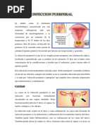 11 Tipos de Incisiones para Una Cesarea | PDF | Parto | El embarazo