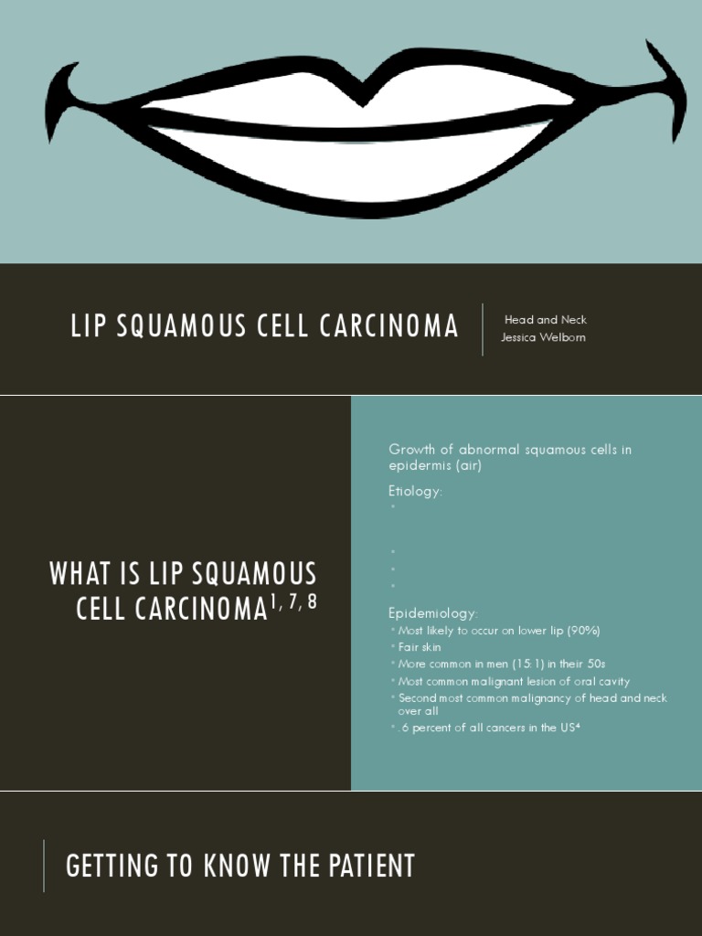 Case Presentation | PDF | Head And Neck Cancer | Biopsy