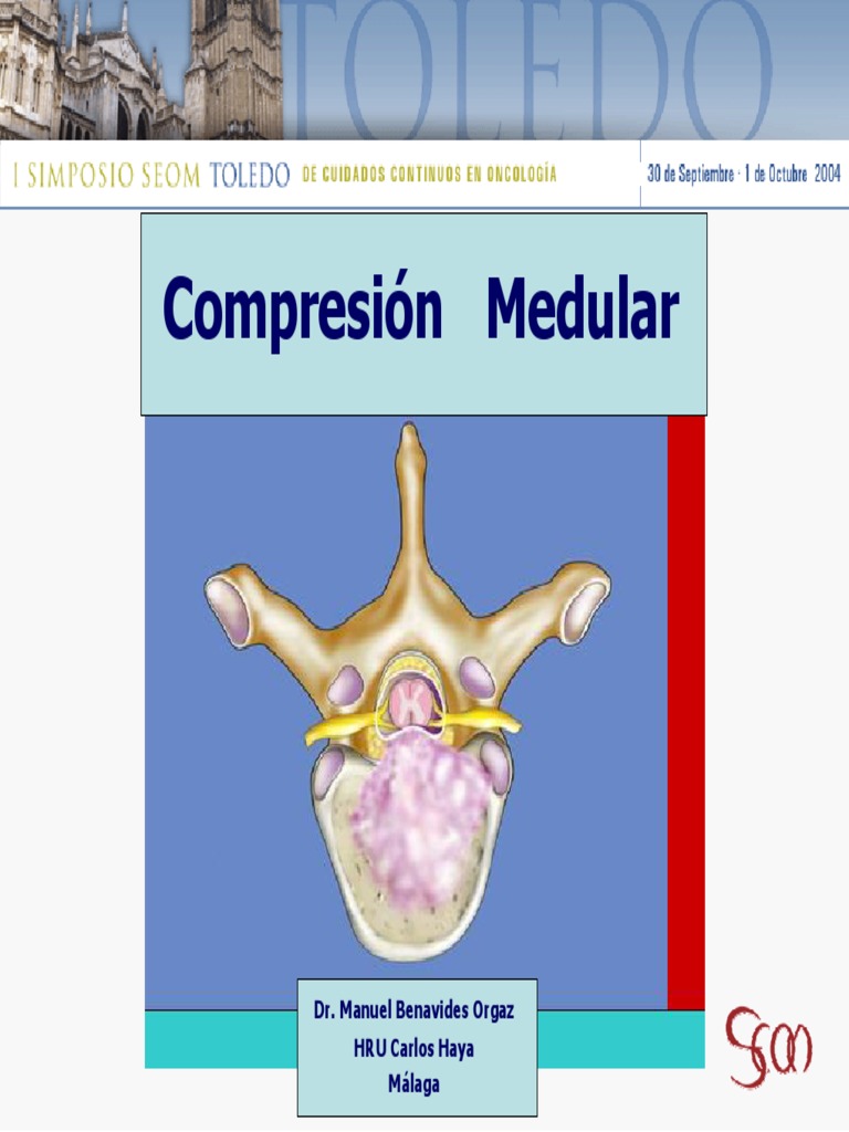 Compresion Medular PDF | PDF | Metástasis | La columna vertebral