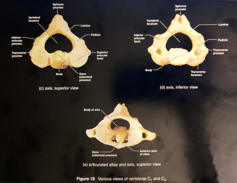 Axis | PDF | Vertebra | Musculoskeletal System