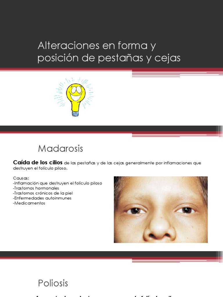 Alteraciones pestañas y cejas: Madarosis, Poliosis, Sinofridia | PDF