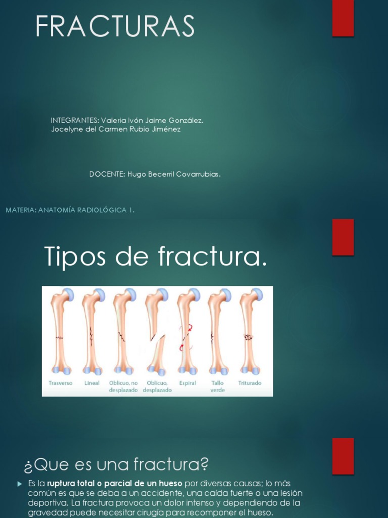 Tipos y Tratamientos de Fracturas | PDF | Hueso | Lesión