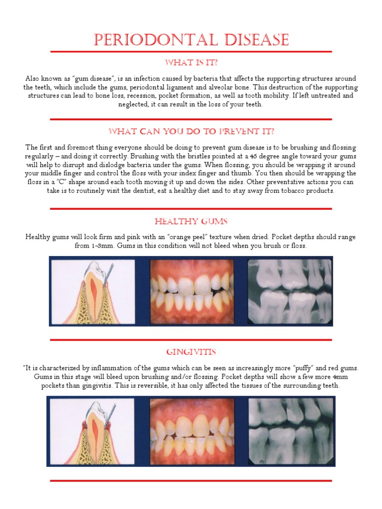 Visual Aid | PDF | Periodontology | Human Tooth