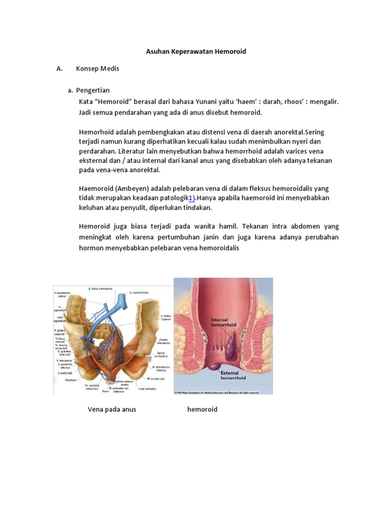 Asuhan Keperawatan Hemoroid | PDF