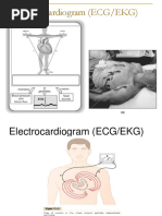ACLS EKG Rhythms and Interpretation | PDF | Heart | Electrocardiography