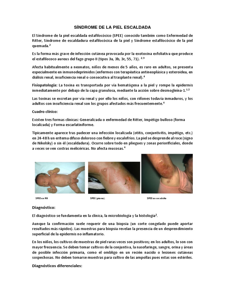 Sindrome de La Piel Escaldada | PDF | Epidermis | Staphylococcus Aureus