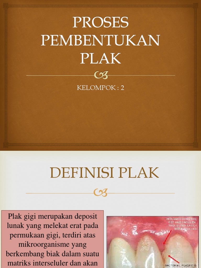 Proses Pembentukan Plak Gigi | PDF